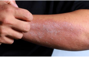 Dermabel Krem Neye Yarar, Fiyatı? - Cilt Bakımım - Cilt Bakımım